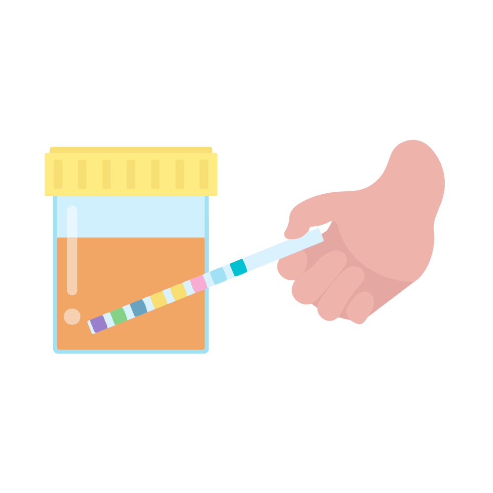 Tout savoir sur les bandelettes urinaires