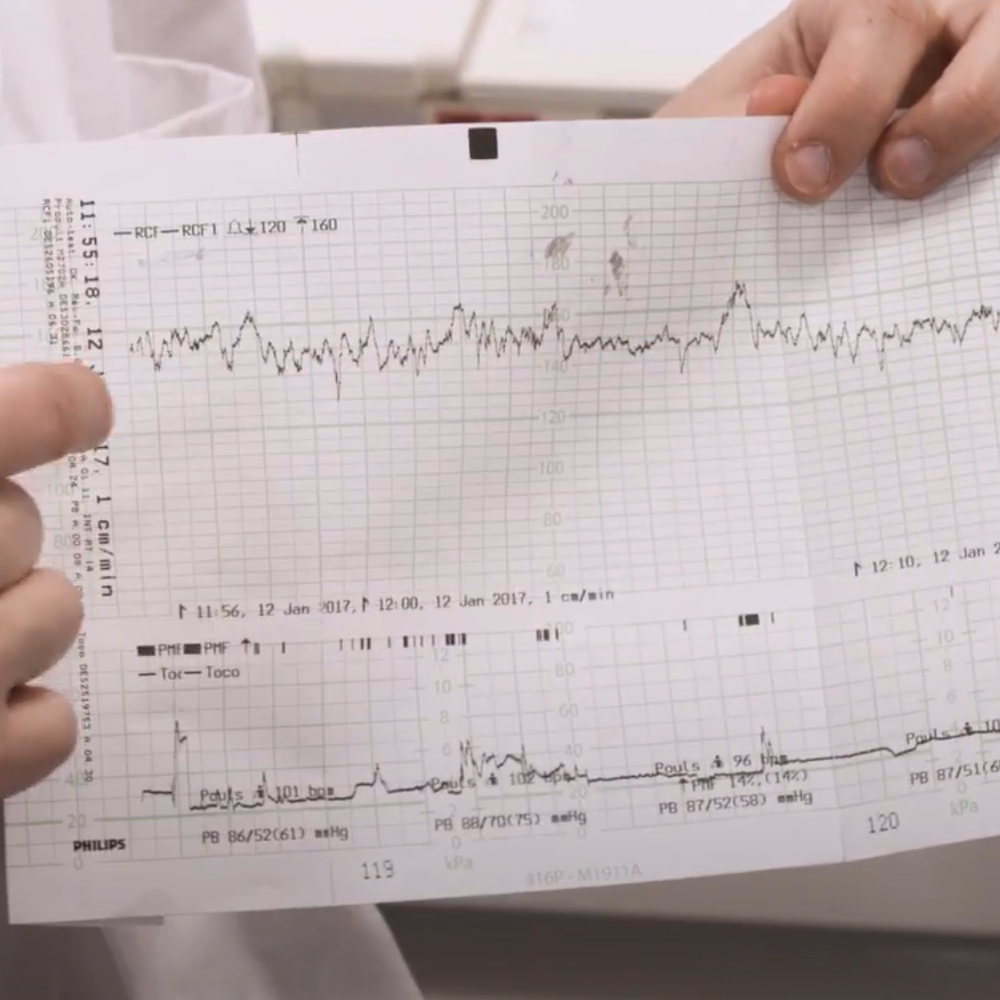 Tout savoir sur le monitoring foetal - Girodmedical Blog : Le blog du ...
