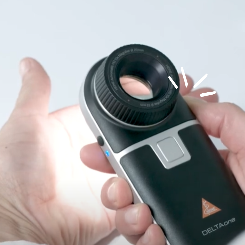 Tout savoir sur le dermatoscope Heine DeltaOne | Girodmedical Blog