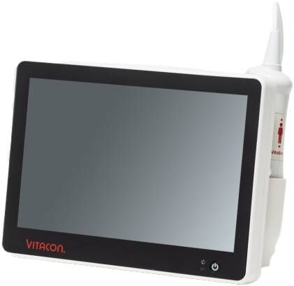 Bladder scanner / Scanner vésical portable eVue VitaScan