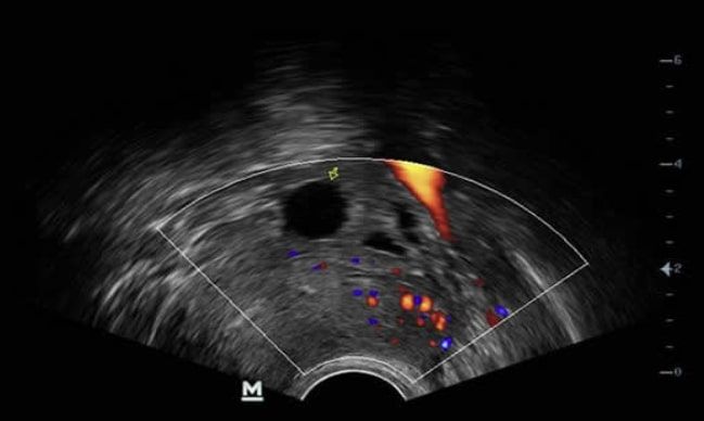 Echographe portable à ultrasons Mindray Z50 | Girodmedical