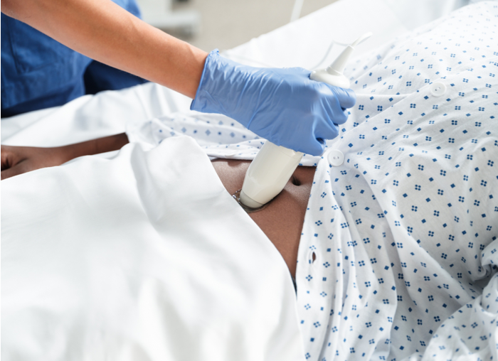 Bladder scanner avec pied à roulettes Vitascan cVue