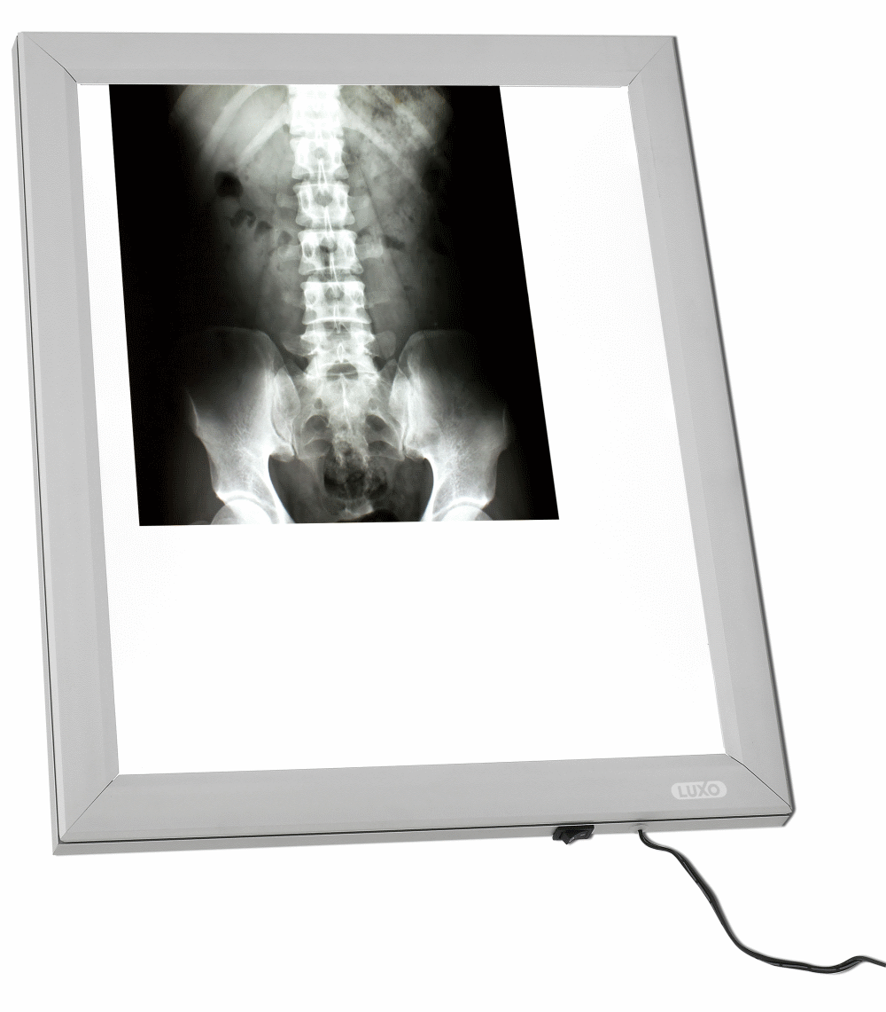 Négatoscope LED AF400 Ulsan à 362,15