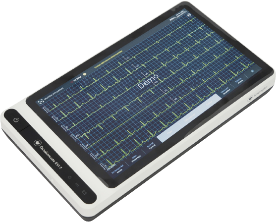 Electrocardiographe ECG Cardiomate EVI (12 pistes) avec interprétation ...