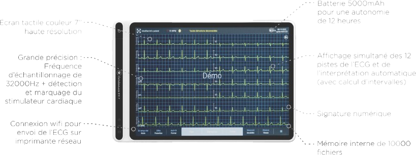 Electrocardiographe ECG Cardiomate EVI (12 pistes) avec interprétation ...