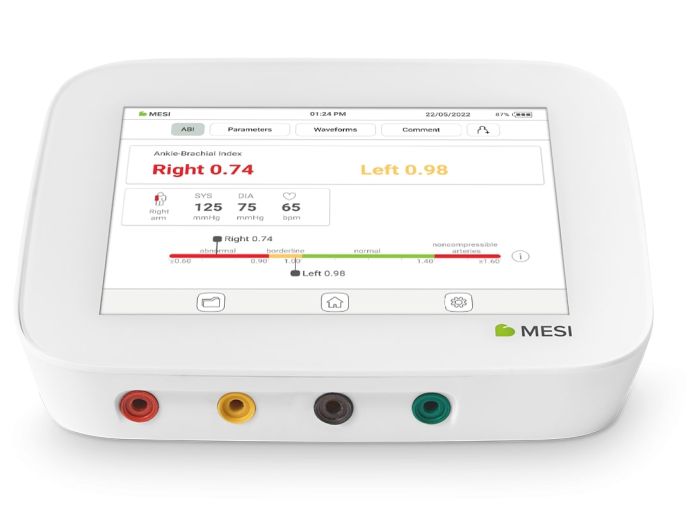 Dispositif MESI ABPI MD pour mesure de l’IPS