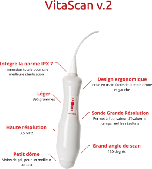 Scanner vésical Vitascan Vitacon