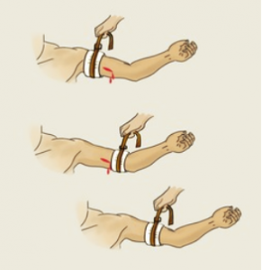 Comment poser un garrot médical ? Nos explications et conseils